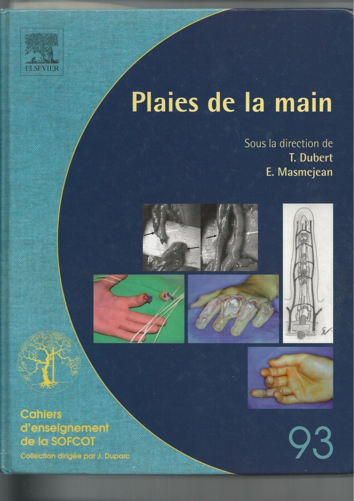 Livres | Chirurgie de la main, de l'épaule et du membre supérieur